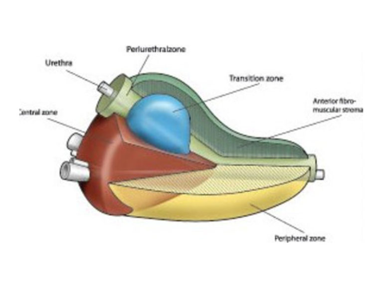 Prostate anatomy : The reasons of the radical treatments side-effects